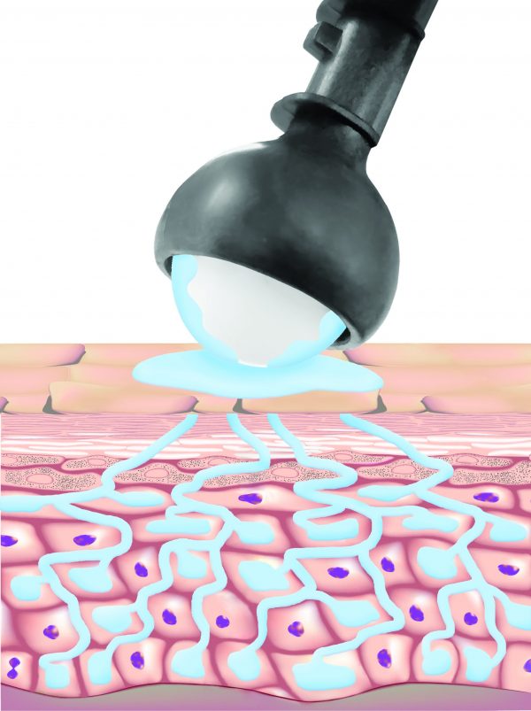 INFUZION SYSTEM® - LONG LASTING BEAUTY