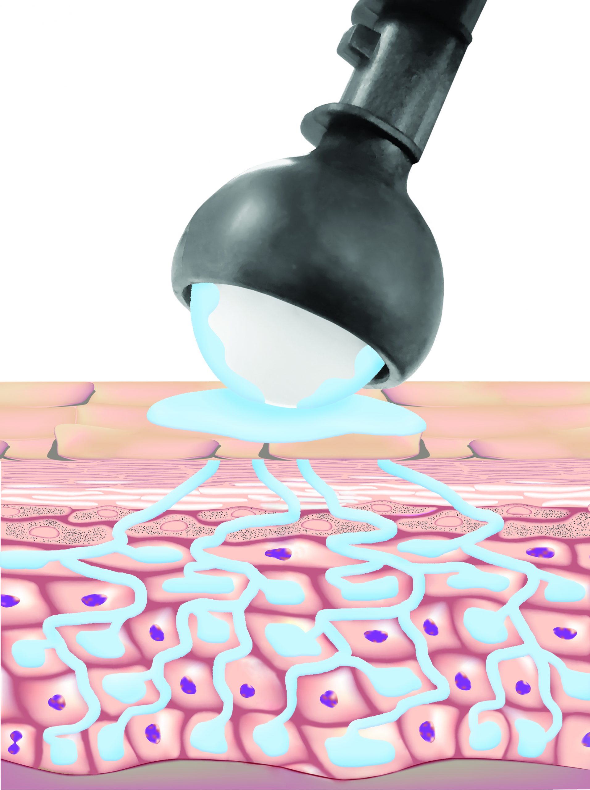 INFUZION SYSTEM® - LONG LASTING BEAUTY